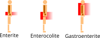 Salute e benessere: Enterite
