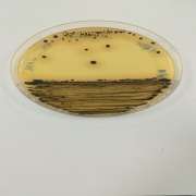 Staphylococcus aureus - Stafilococco aureo - microbiologia